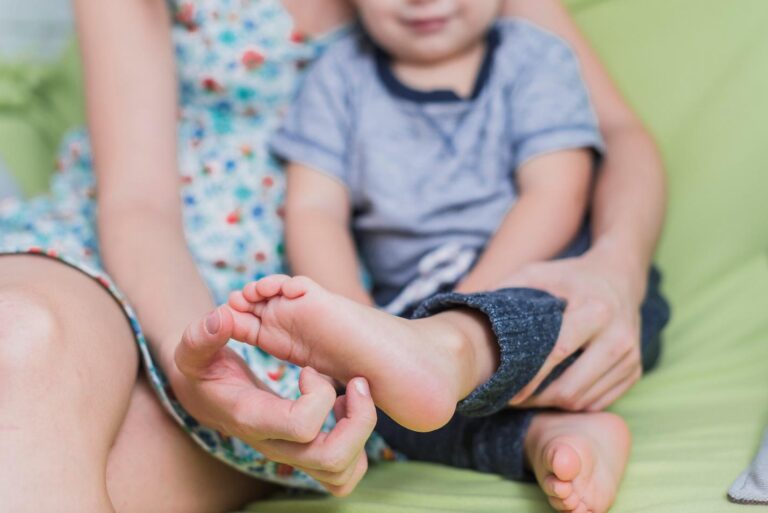 The Foot Deformities Commonly Seen in Babies with Cerebral Palsy ...